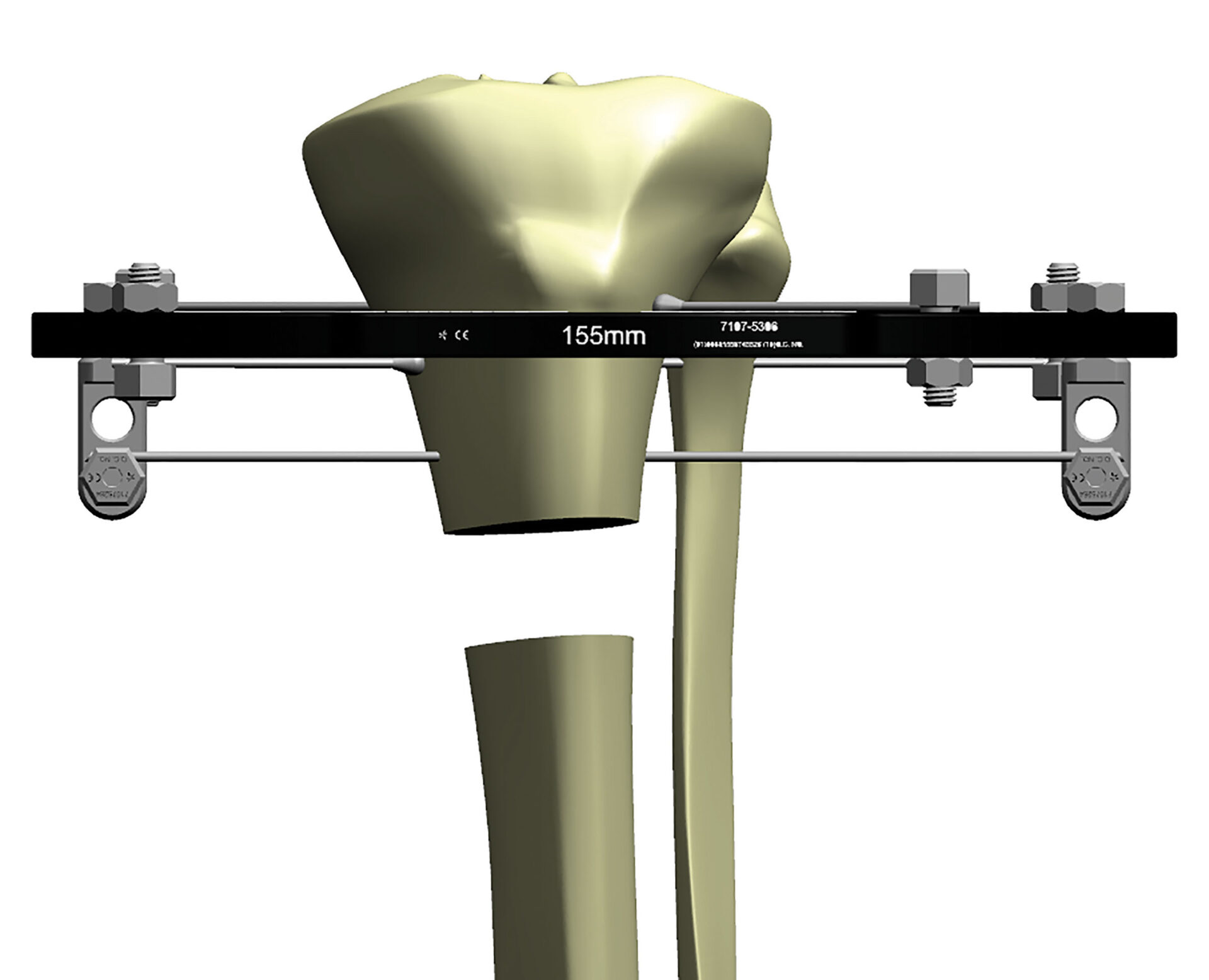 Constructing a Stable Frame - Compendium of TSF Applications