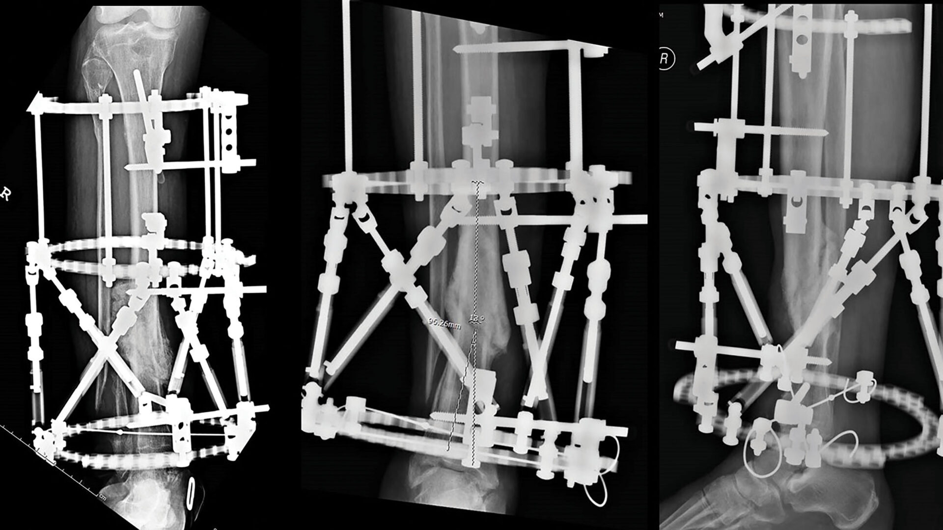 Constructing a Stable Frame - Compendium of TSF Applications