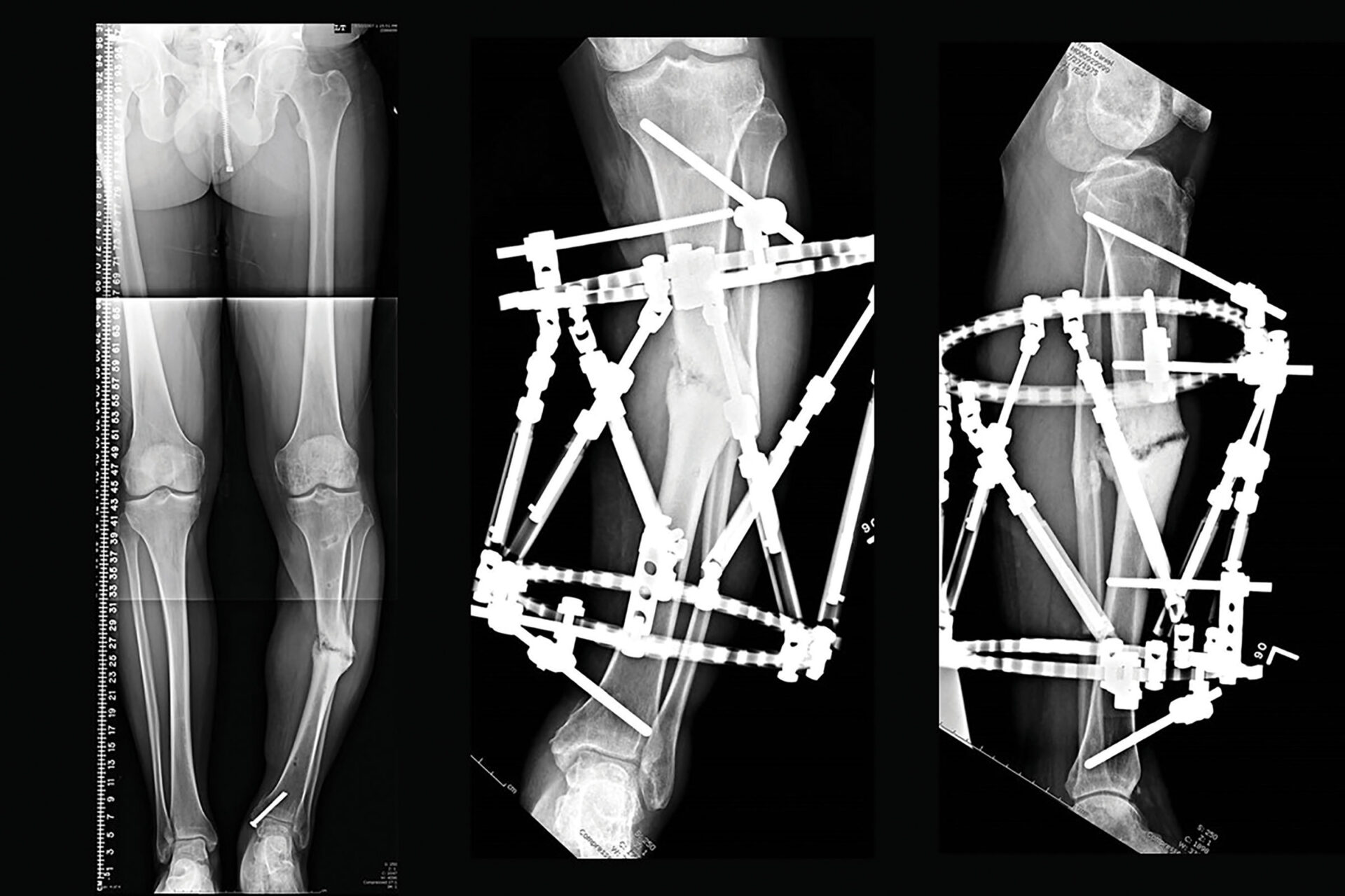 Constructing a Stable Frame - Compendium of TSF Applications