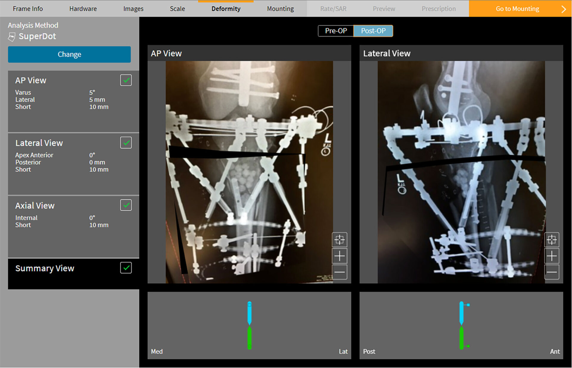 Techniques in Trauma - Compendium of TSF Applications
